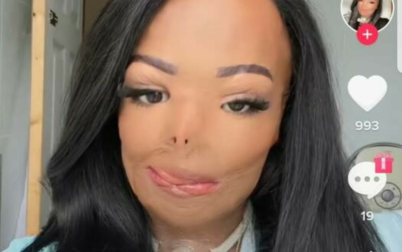 Cum arată Aleema Ali, tânăra vedetă pe Tik Tok după ce a suferit arsuri ...