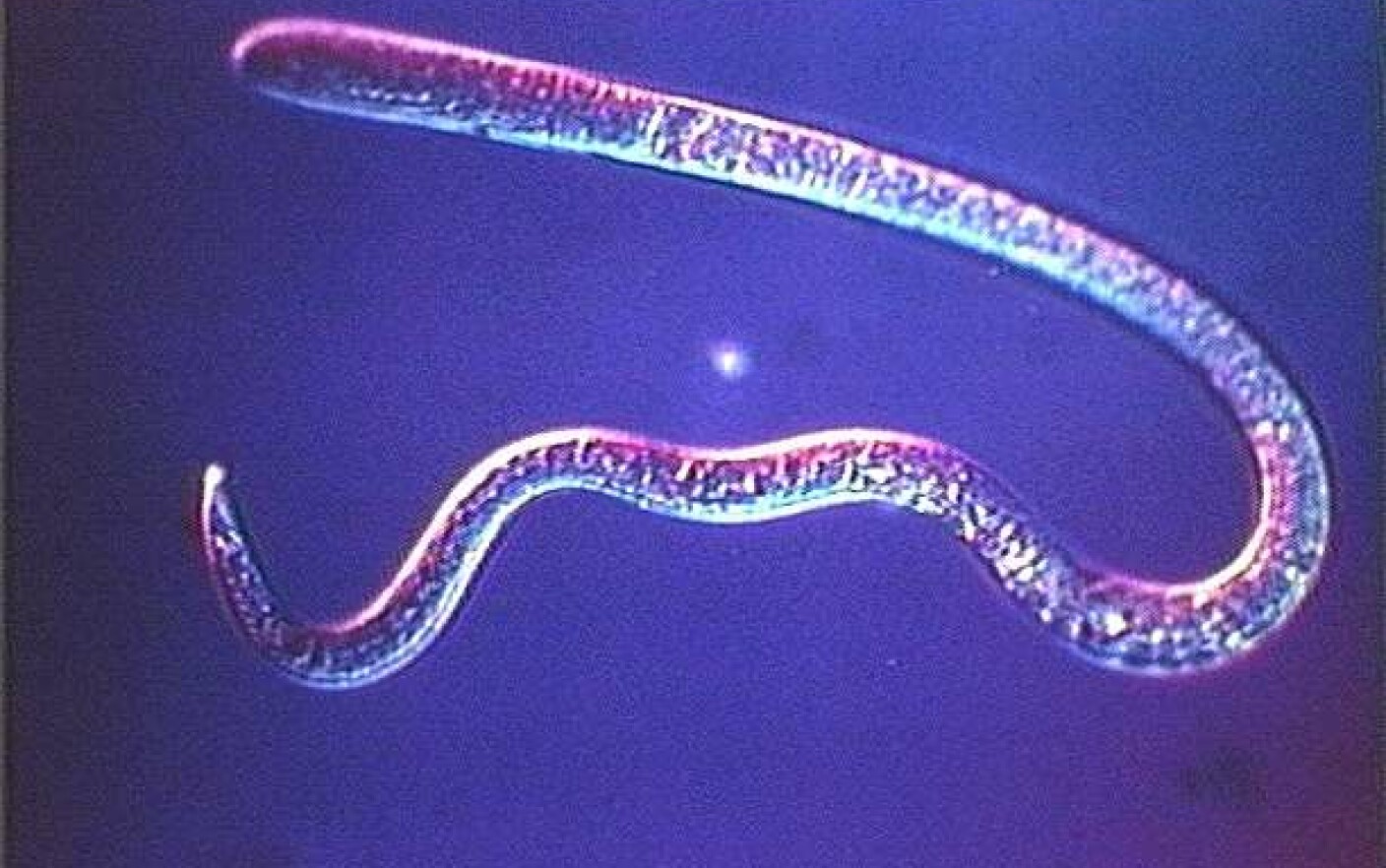 Am intrat in "sezonul trichinelozei"! Afla cum sa eviti imbolnavirea ...