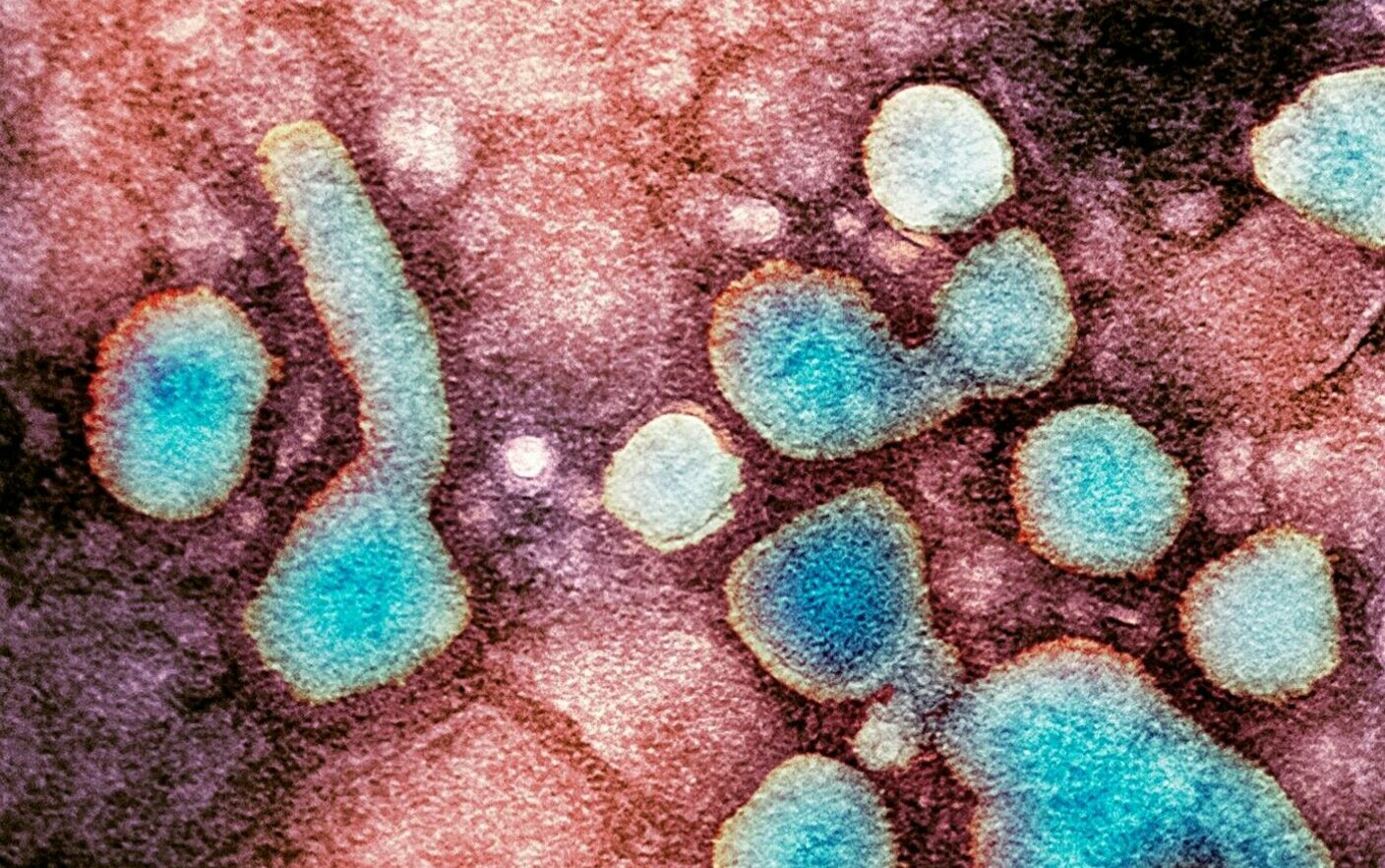 O fată de 11 ani a murit în Cambodgia, după ce a fost infectată cu ...