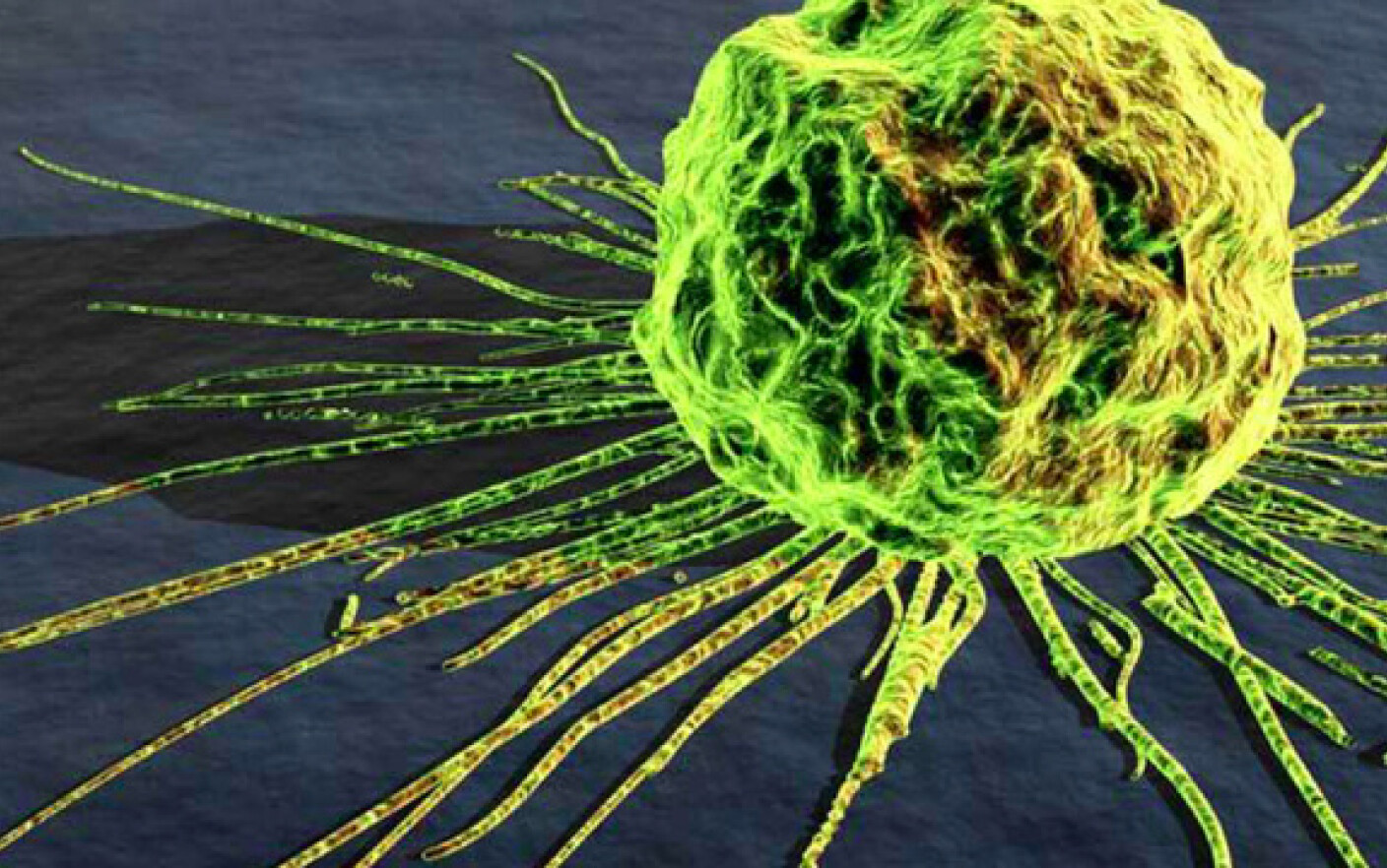 Cancerul impotriva cancerului. Medicii au gasit o tumoare mutanta care ...