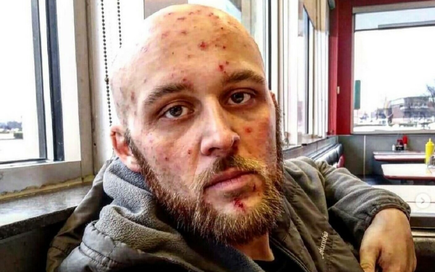 A câștigat o luptă cruntă. Transformare uluitoare a unui tânăr care s-a ...