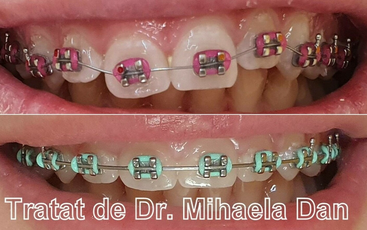 (P) Aparatul dentar și succesul în carieră - Stirileprotv.ro