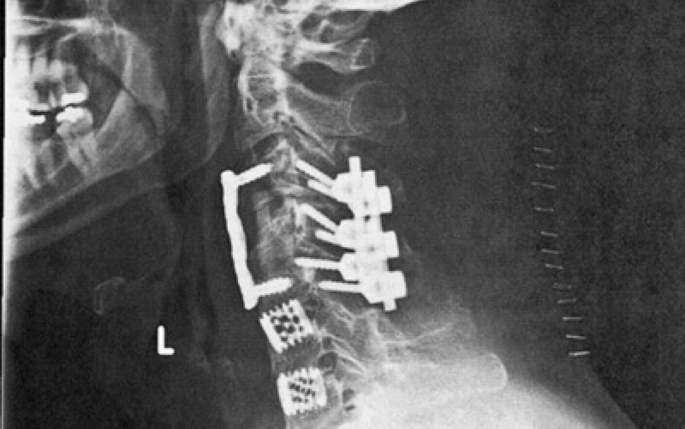 Legatura dintre aceasta imagine si dependenta de medicamente a unei ...