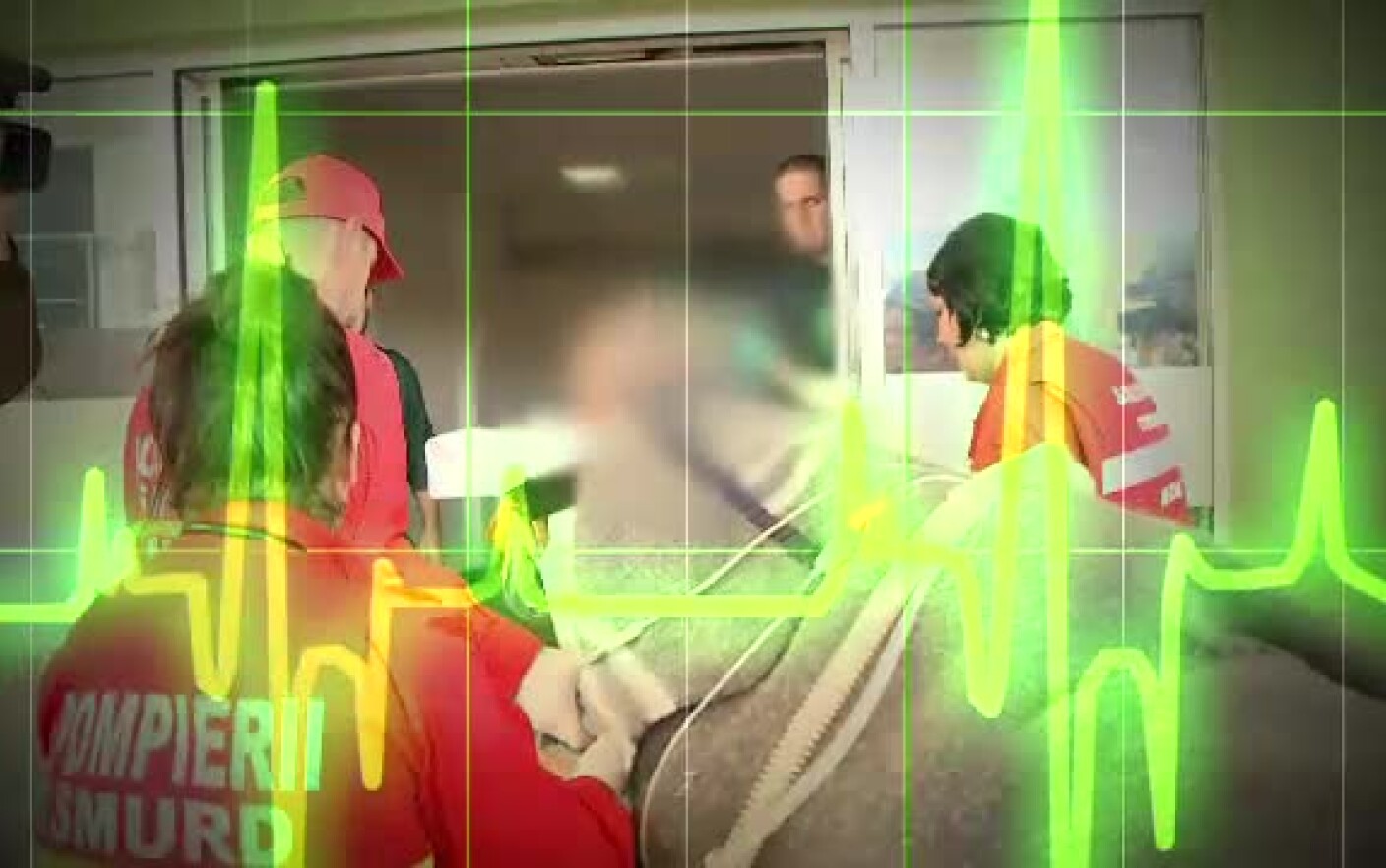 Michi de la Suie Paparude, inca in coma indusa. Vestea buna e ca nu are ...