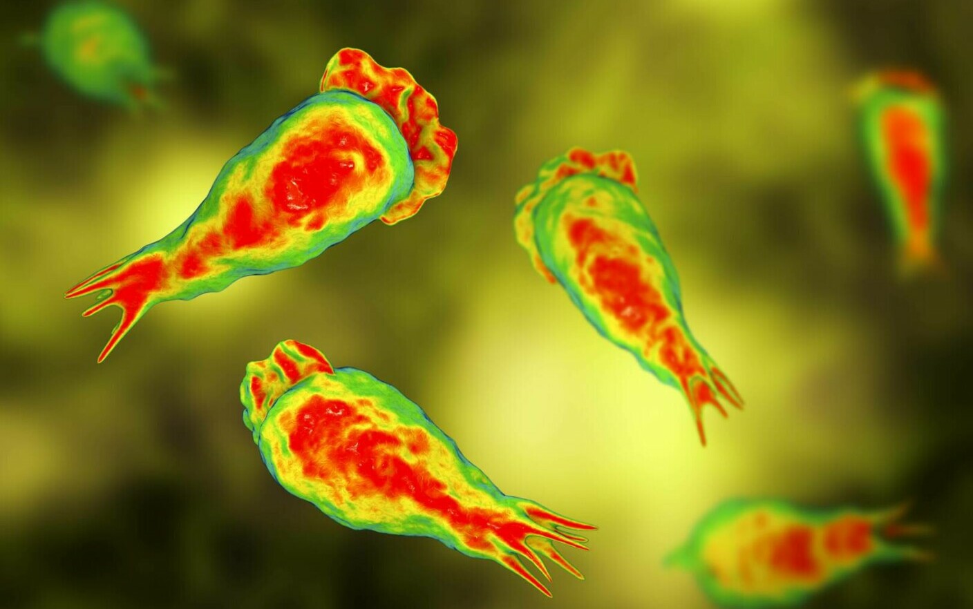 Un adolescent din Las Vegas a murit după ce a contractat o amibă care ...