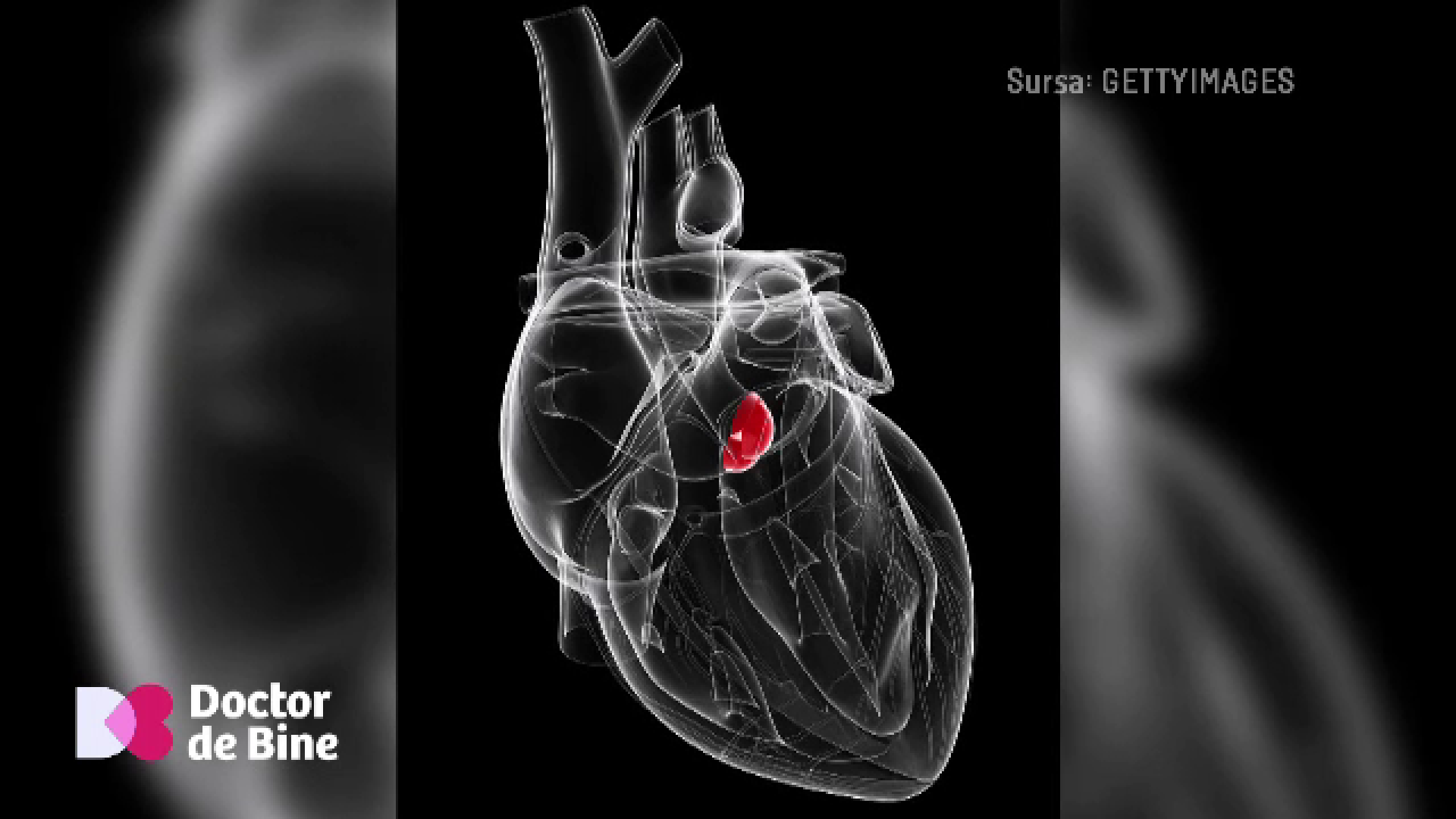 Când trebuie investigate valvele inimii și care este boala care le ...