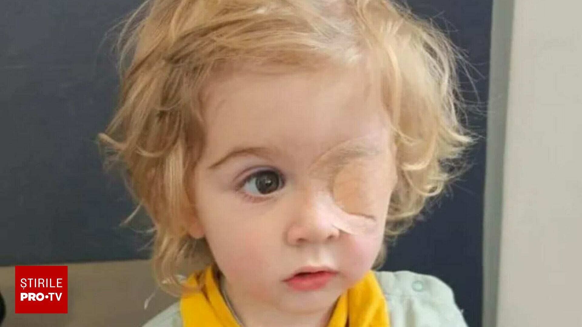 Un copil de 2 ani și-a pierdut vederea după ce a fost sărutat pe unul dintre ochi de o persoană ...