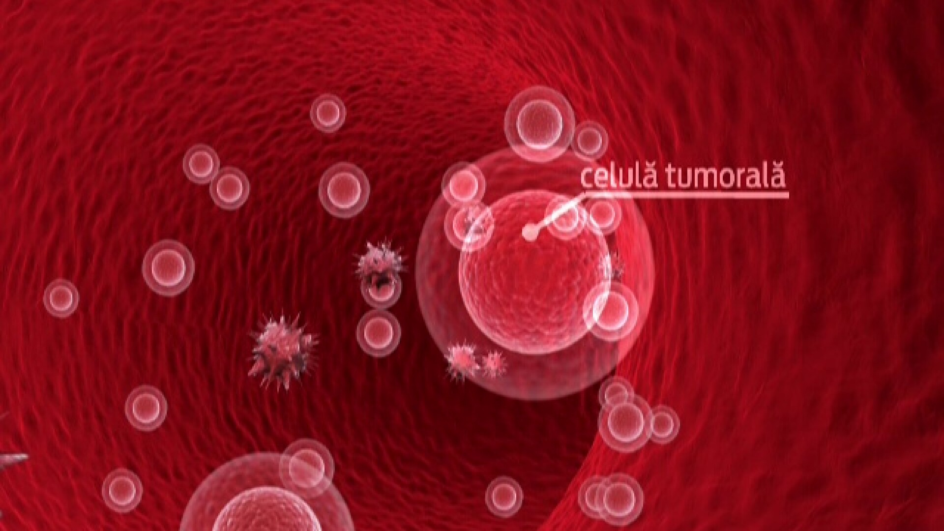 Terapia revolutionara care face minuni in tratarea cancerului. In ...