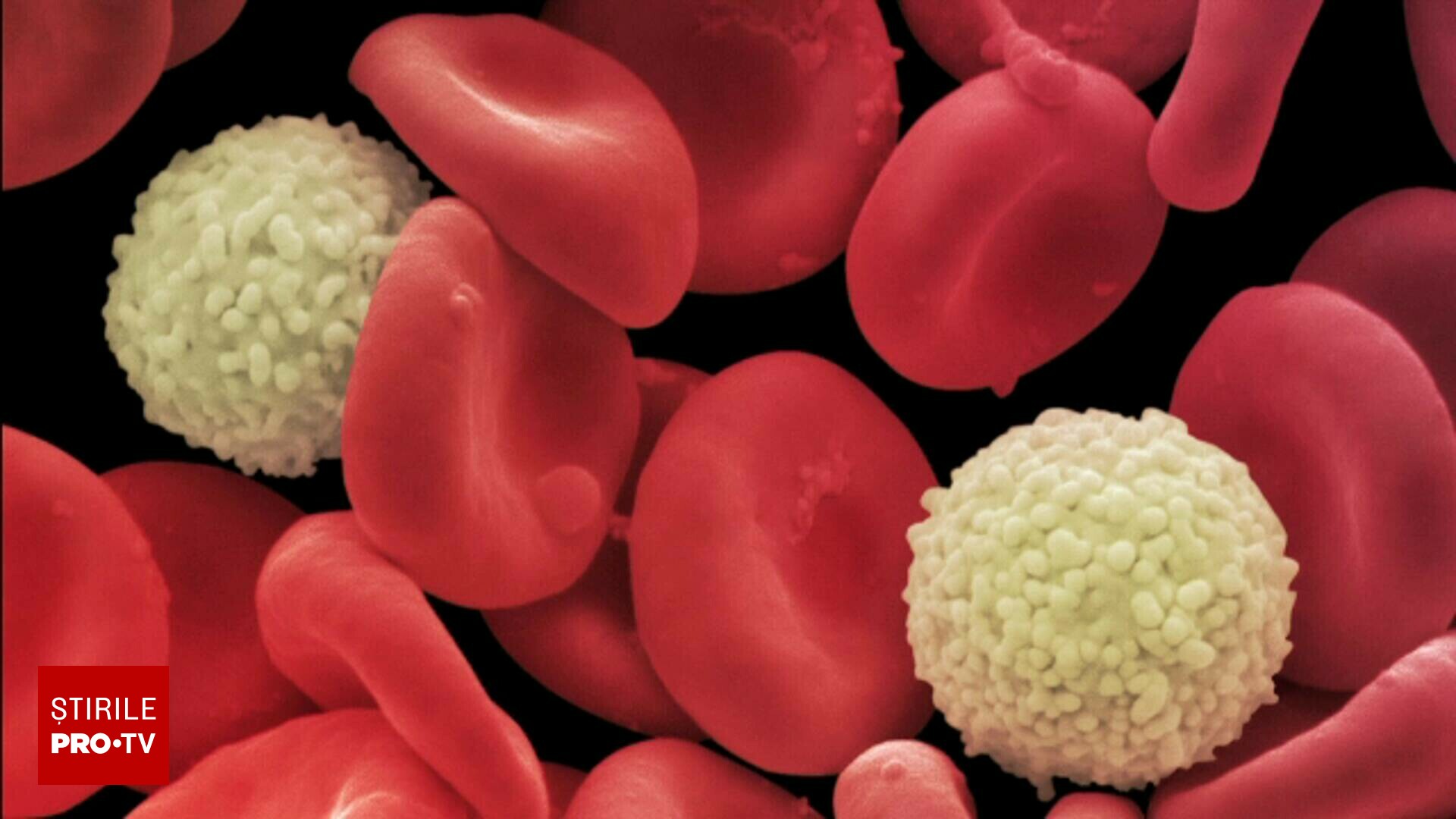 Cele mai importante analize care se fac sub 50 de ani: hemoleucograma ...