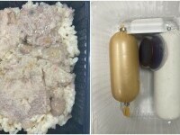 Ministrul Sănătății a publicat imagini revoltătoare cu mâncarea oferită într-un spital: Ești ceea ce le servești pacienților
