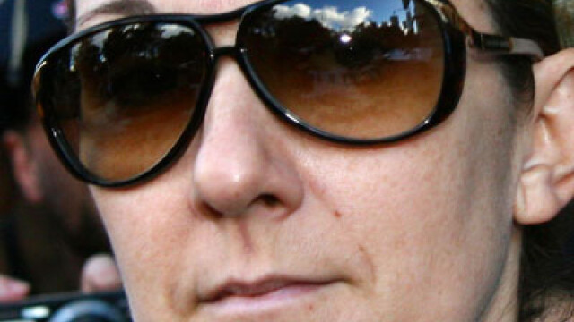 Fata urata a celebritatilor! O GALERIE FOTO cu adevarat infricosatoare ...