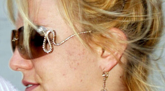 Fata urata a celebritatilor! O GALERIE FOTO cu adevarat infricosatoare ...