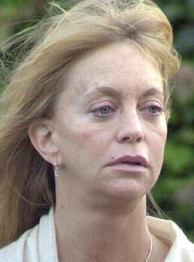 Fata urata a celebritatilor! O GALERIE FOTO cu adevarat infricosatoare ...