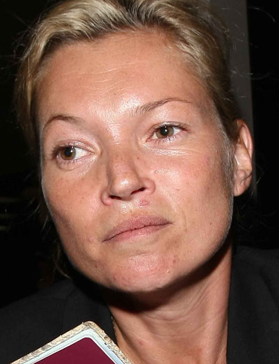 Fata urata a celebritatilor! O GALERIE FOTO cu adevarat infricosatoare ...